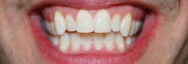 Smile Gallery - Dawson Dental