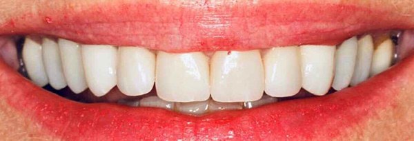 Smile Gallery - Dawson Dental