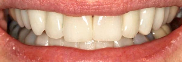 Smile Gallery - Dawson Dental