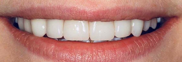 Smile Gallery - Dawson Dental