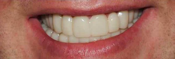 Smile Gallery - Dawson Dental